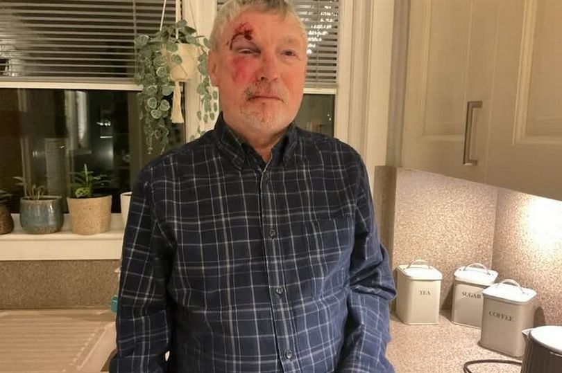 Boss of Scotland's oldest record shop split head open after chasing ...