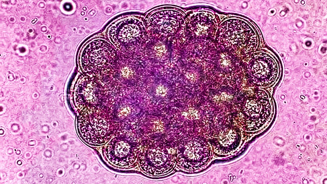 Cancer deaths surging worldwide, scientists warn of looming crisis