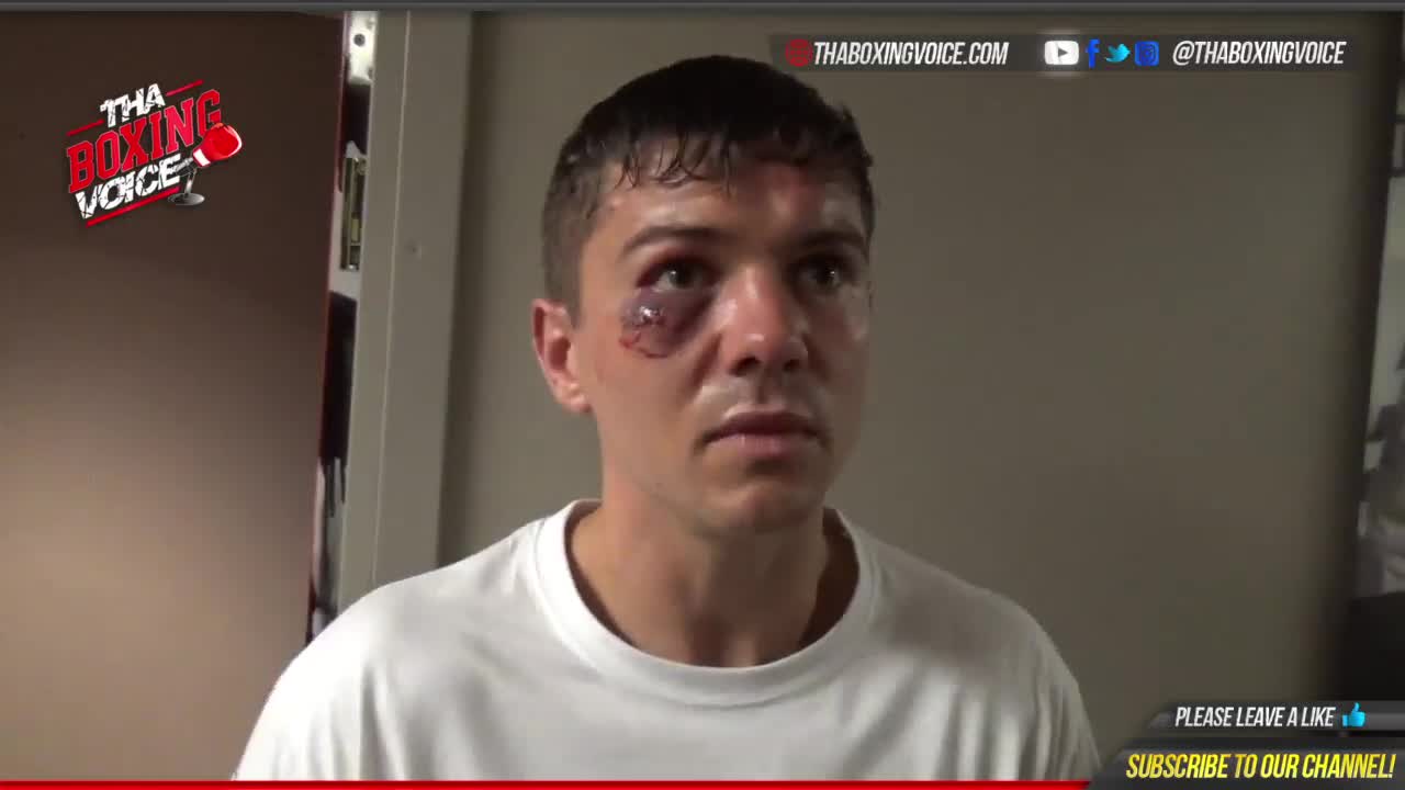 Luke Campbell: Immediate reaction to losing fight with Linares