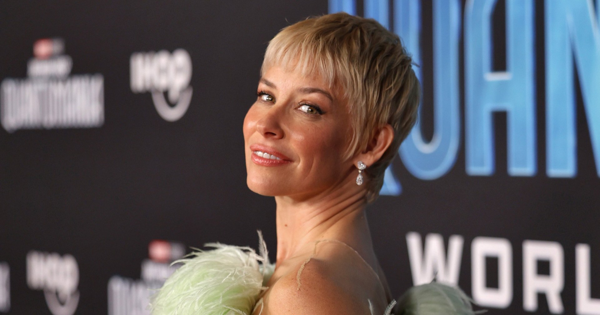 Marvel star reveals brain damage after accident