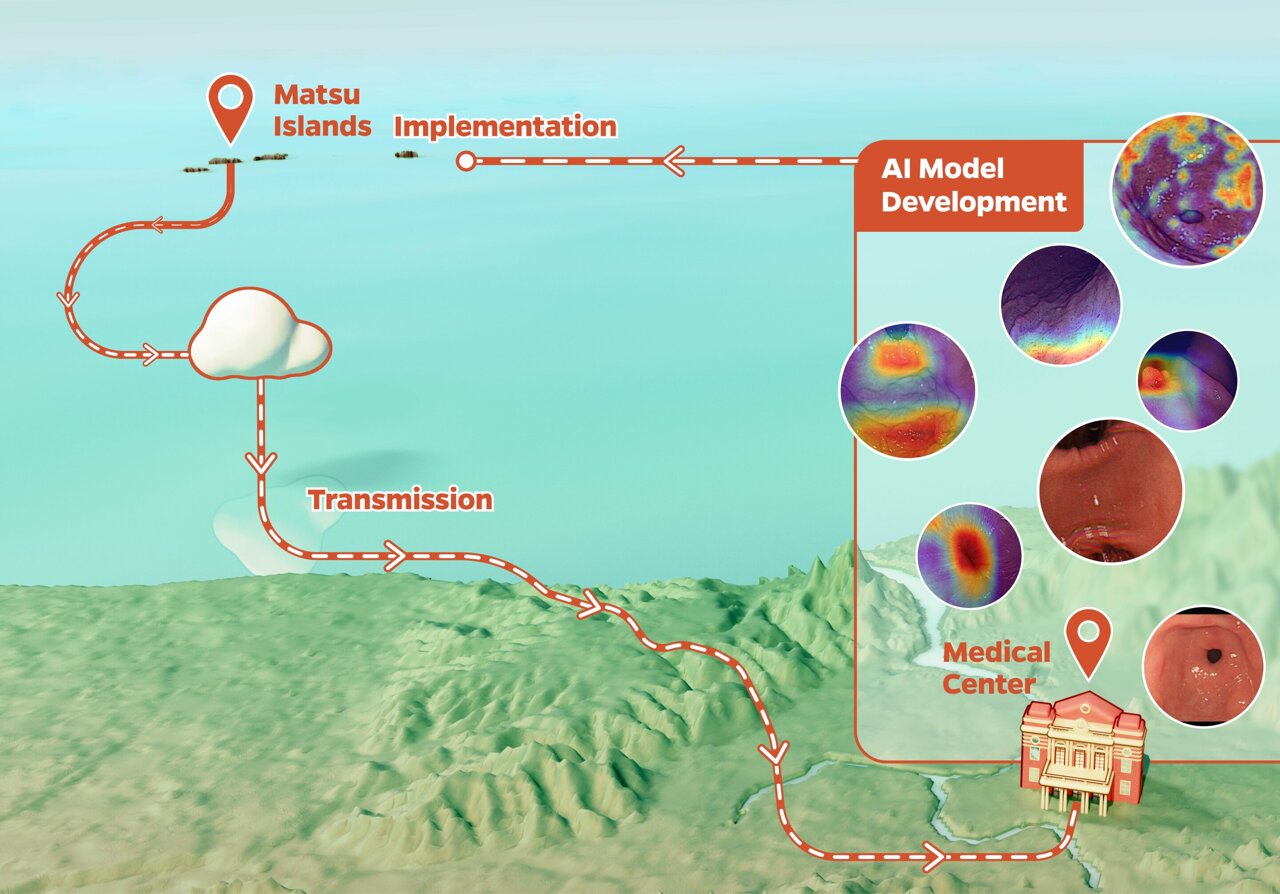 AI detects stomach cancer risk in remote communities from upper ...