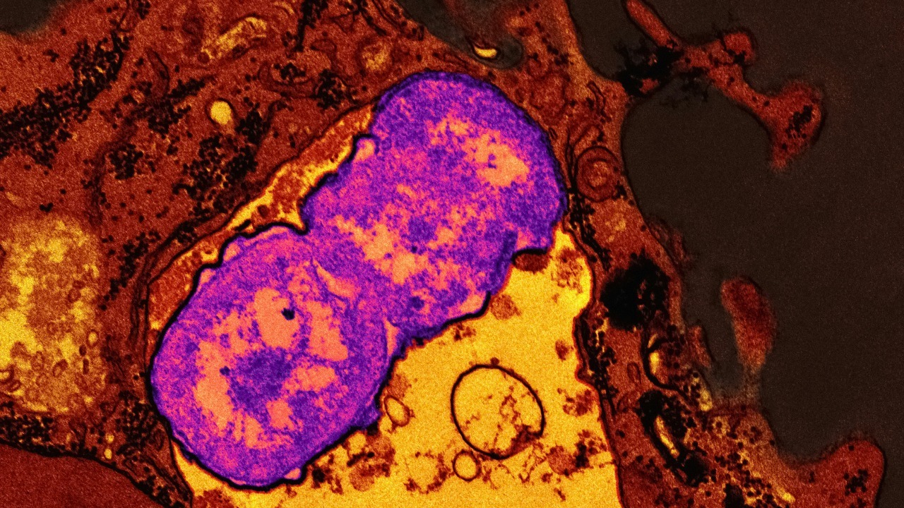 Scientists link 2 cancer hallmarks in a way no one expected