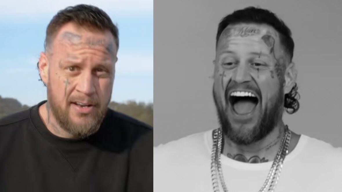 Jelly Roll's remarkable transformation: A journey to health