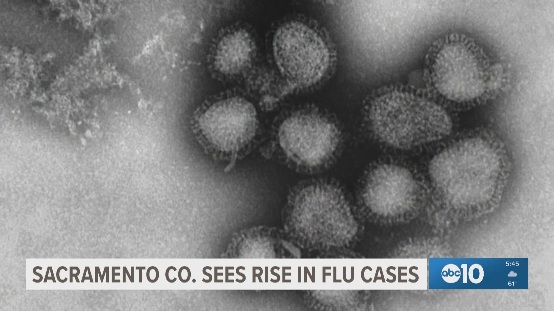 Sacramento County reports flu spike during Christmas week
