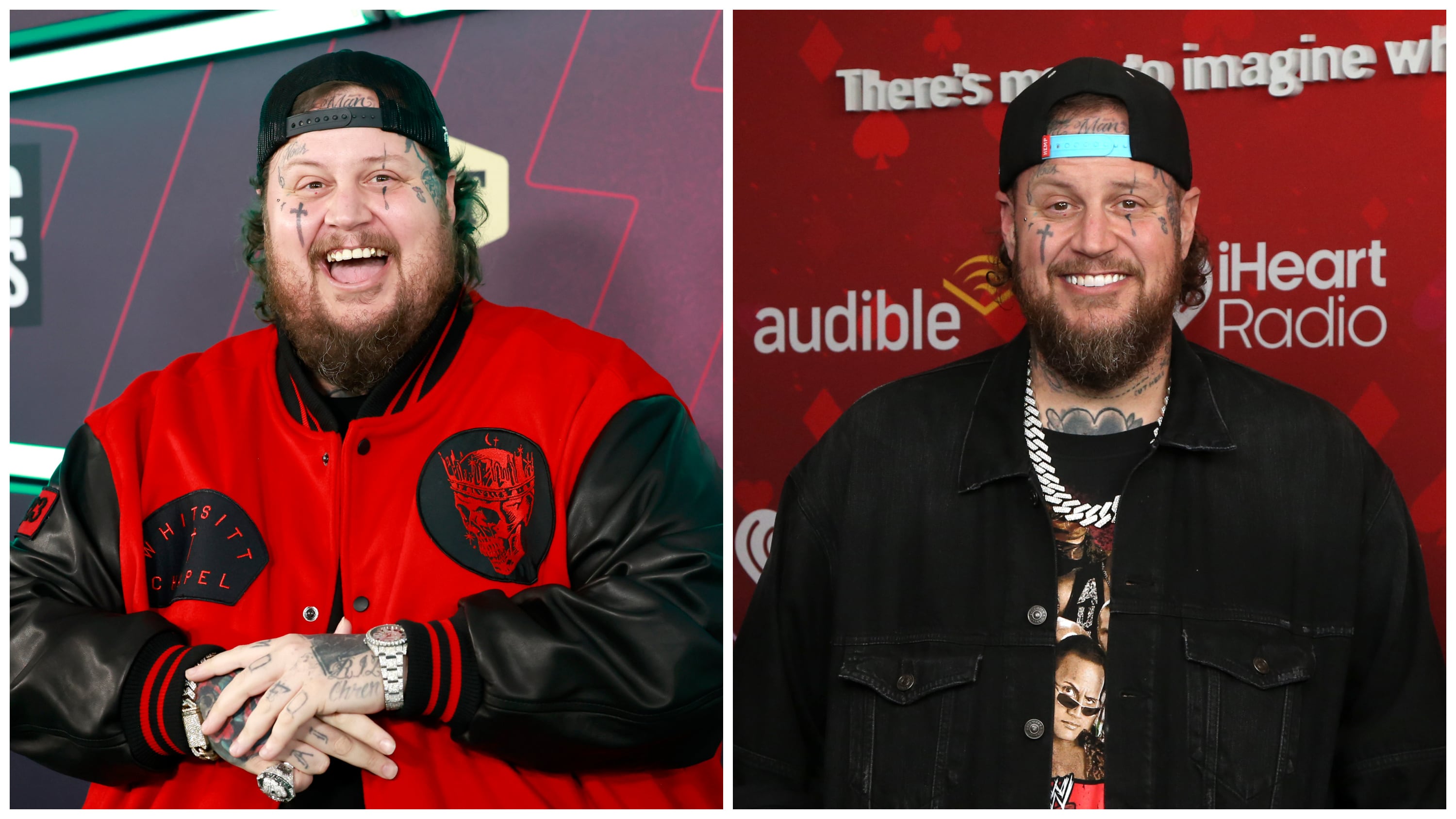 Jelly Roll confesses major setback in his weight-loss journey