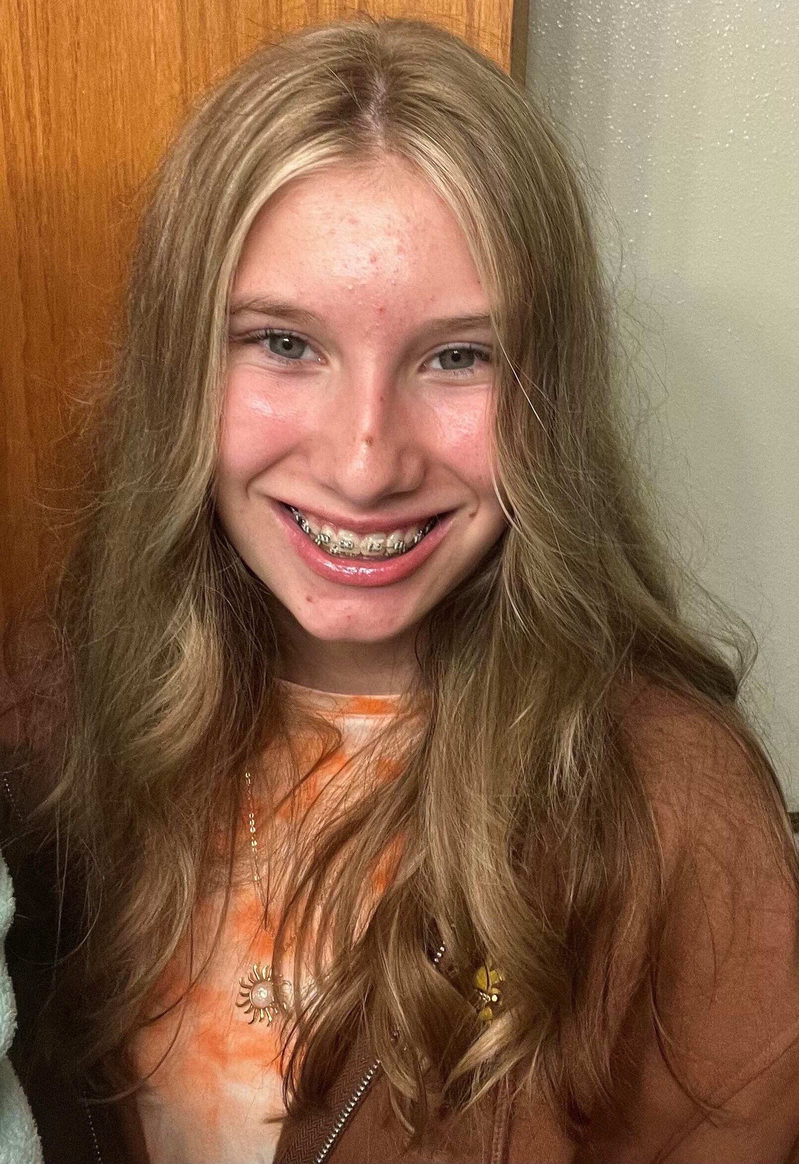 Iowa teen honored at Rose Parade for saving 6 lives through organ donation