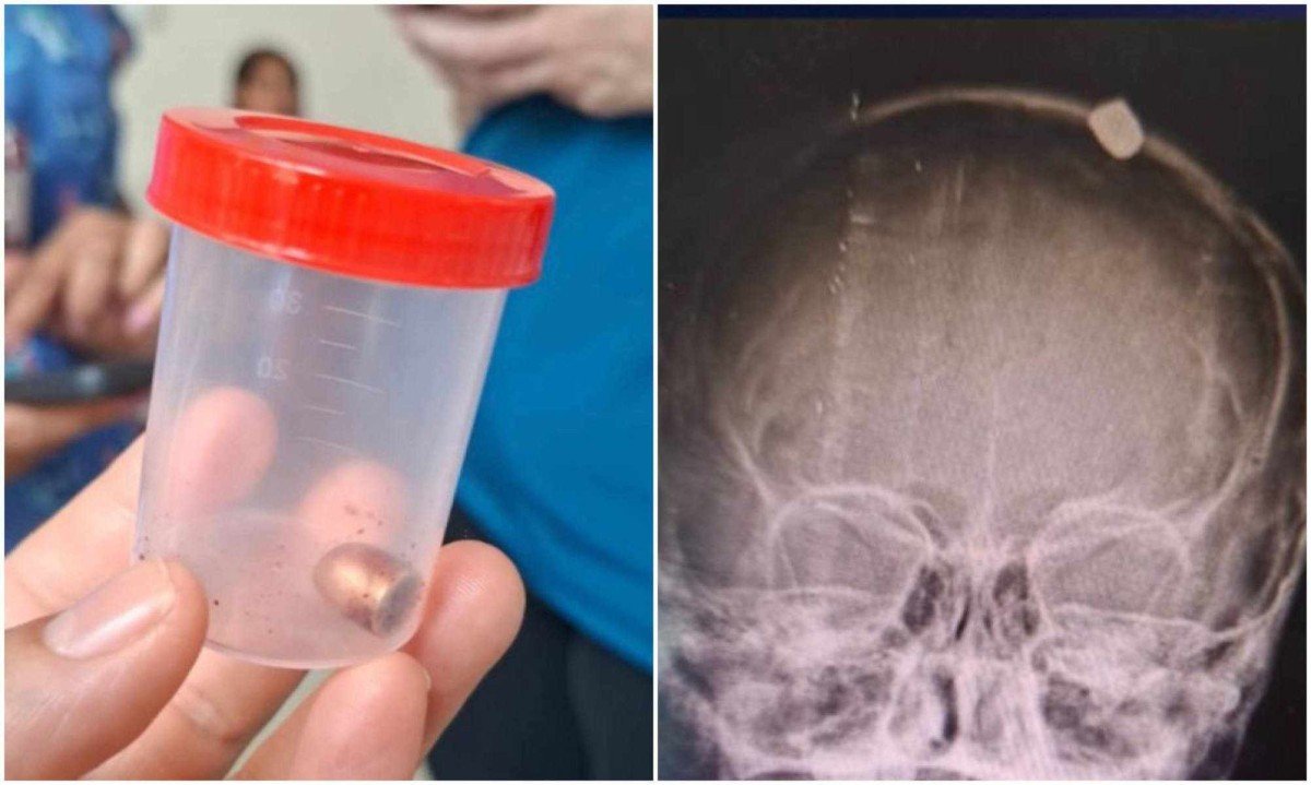 Menino é atingido por bala perdida durante virada do ano na Grande BH