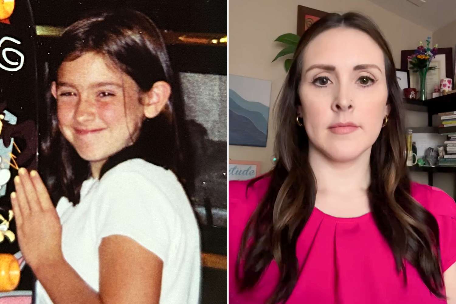 Woman claims she was 'forced' to get plastic surgery at 11. The ...