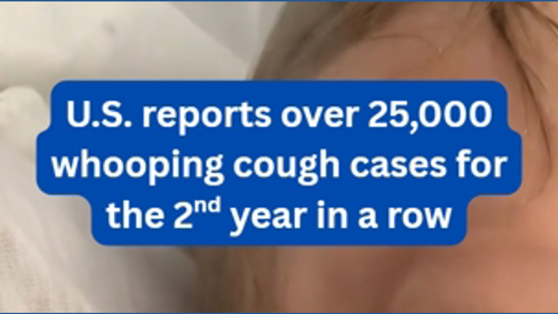 US reports more than 25,000 whooping cough cases for 2nd year in a row