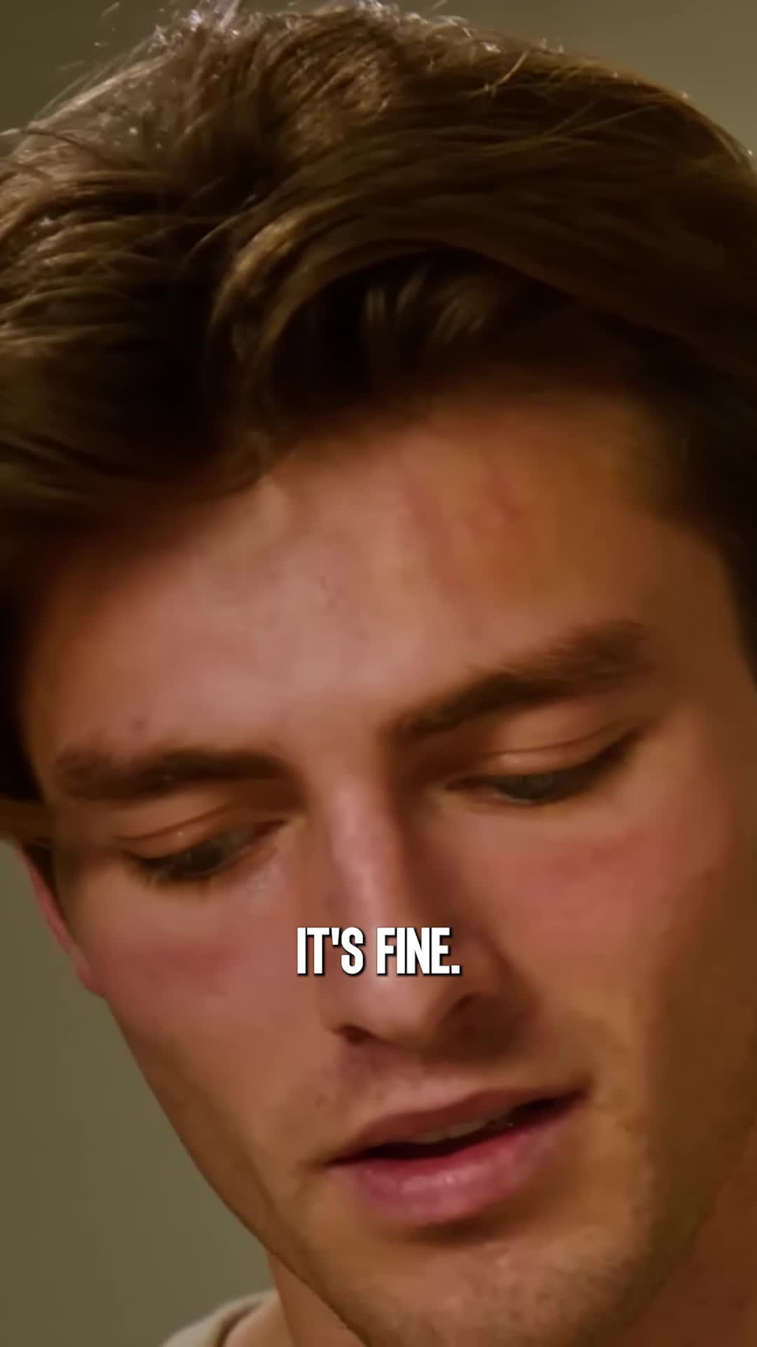 Girl takes lip filler way too far