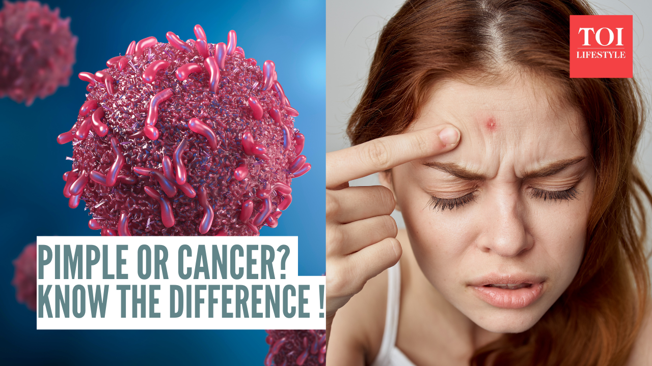 Basal cell skin cancer: Dermatologist explains how it can be mistaken ...