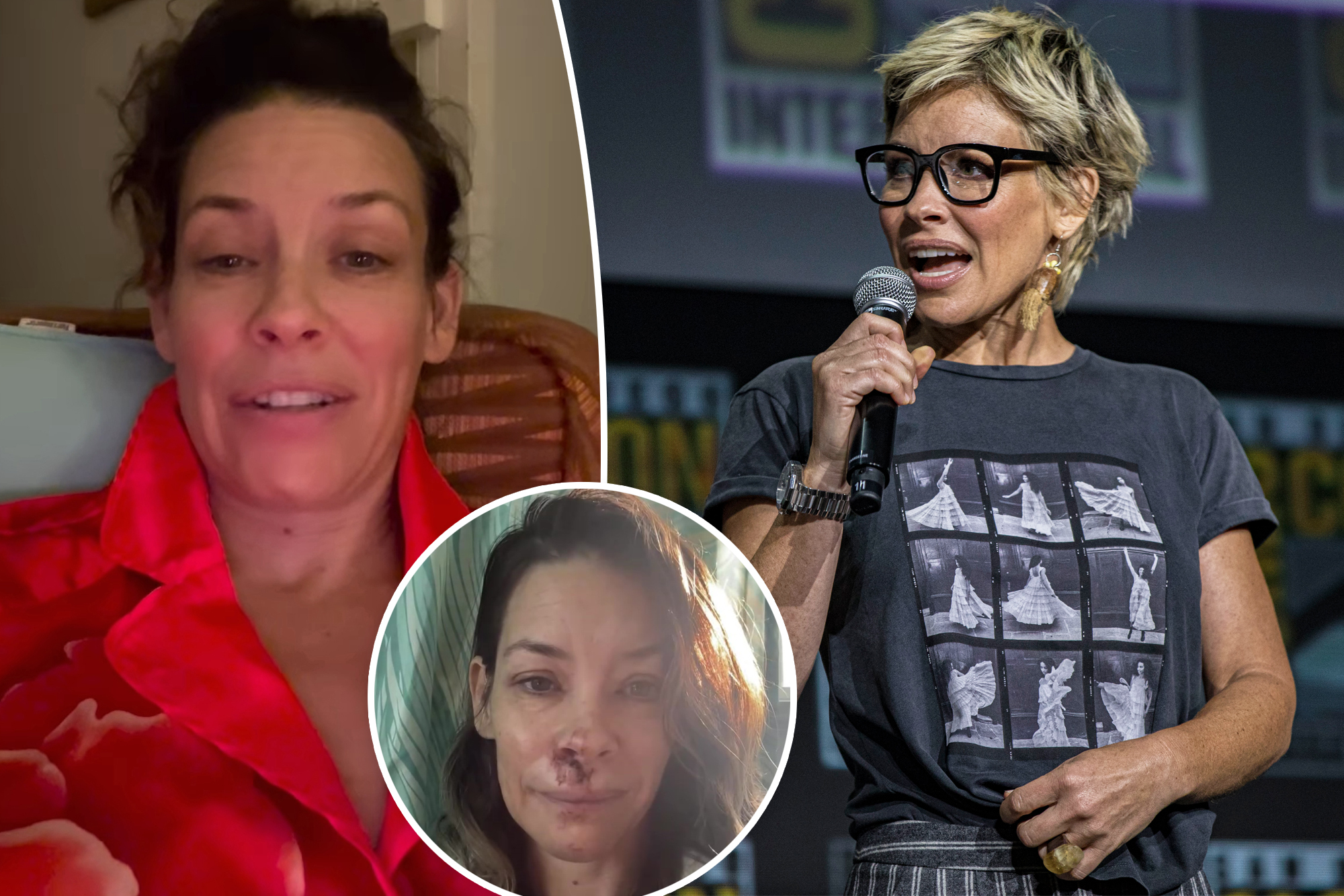 Evangeline Lilly shares devastating brain injury months after falling ...