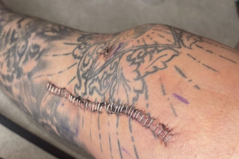 Partick Thistle star pulls back curtain on incredible fightback after ...