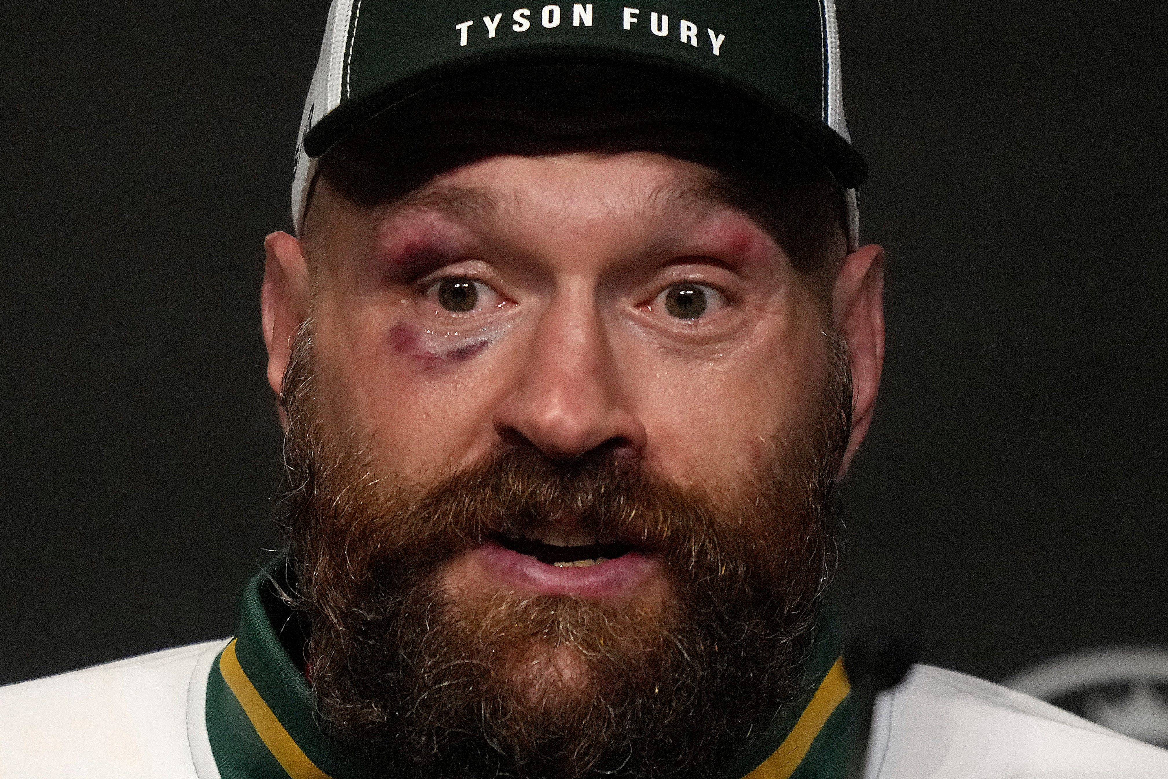 Tyson Fury says he is coming out of retirement in 2026