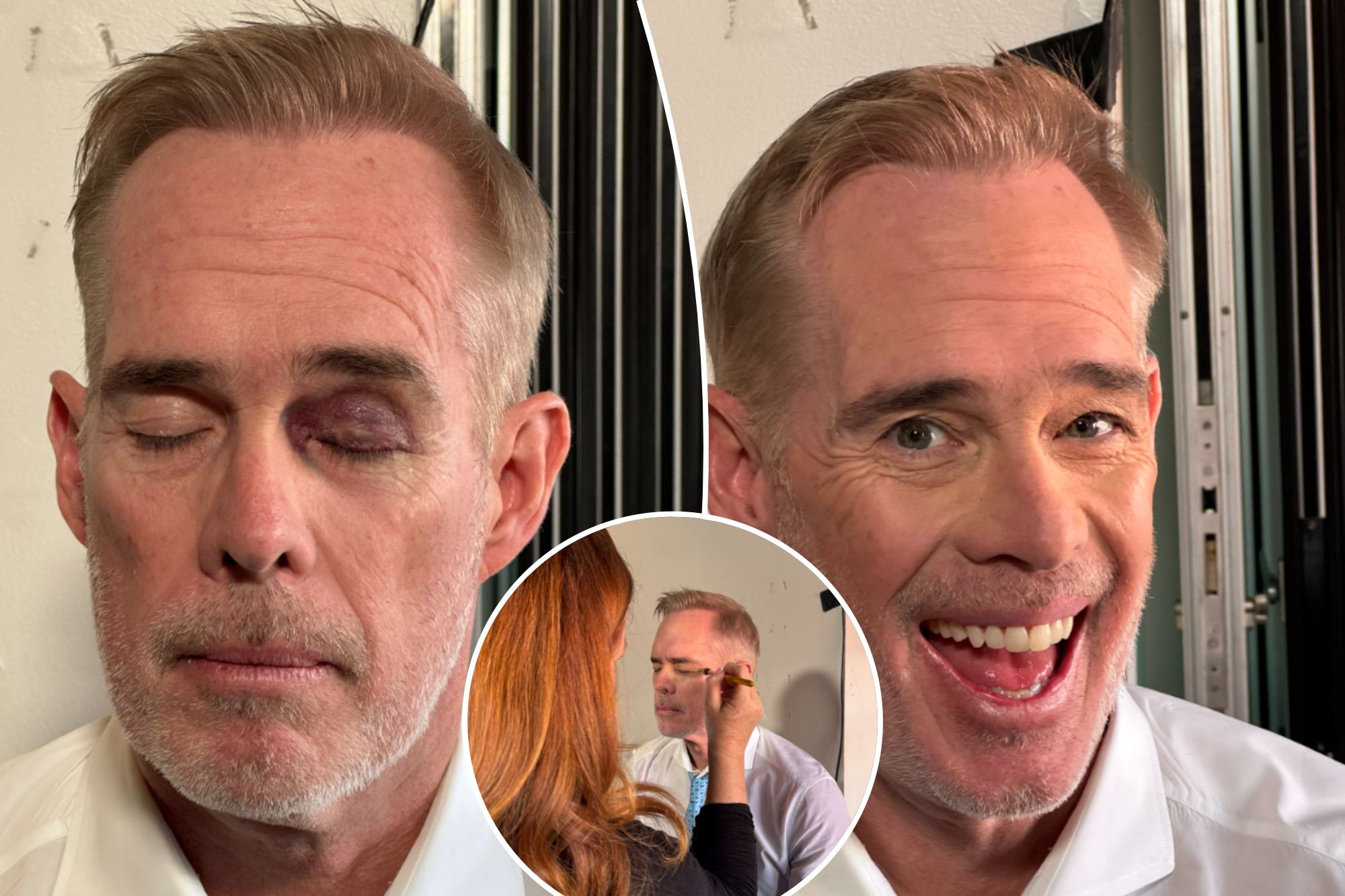 Joe Buck reveals black eye hidden by ESPN makeup artist after Seahawks ...