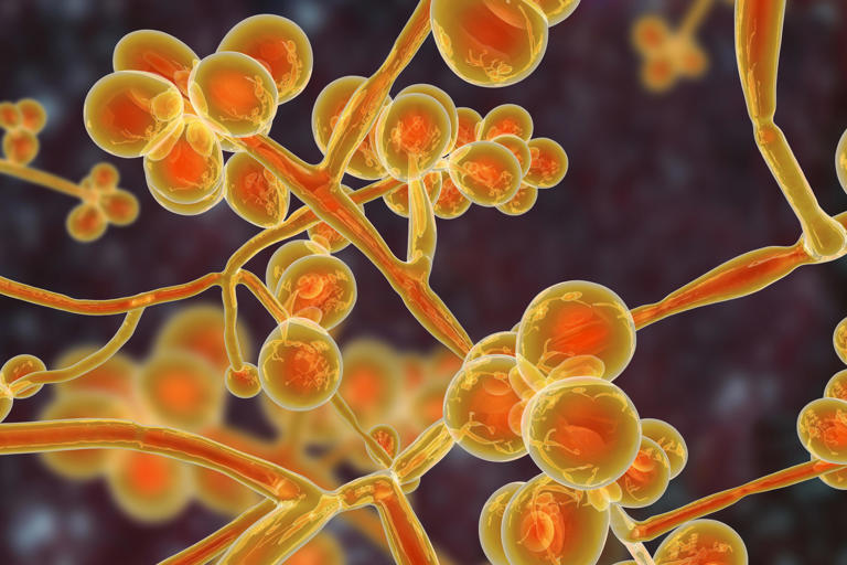 Deadly drug-resistant superbug spreading across US