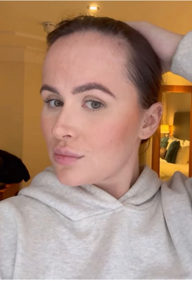 After years of cruel comments, woman decided to undergo forehead ...