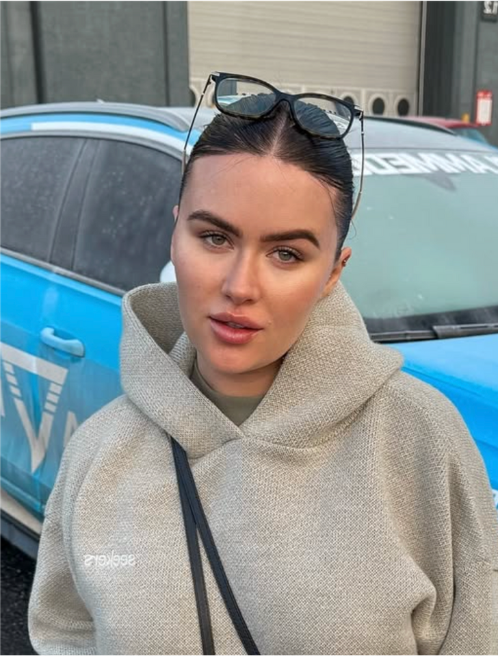 After years of cruel comments, woman decided to undergo forehead ...