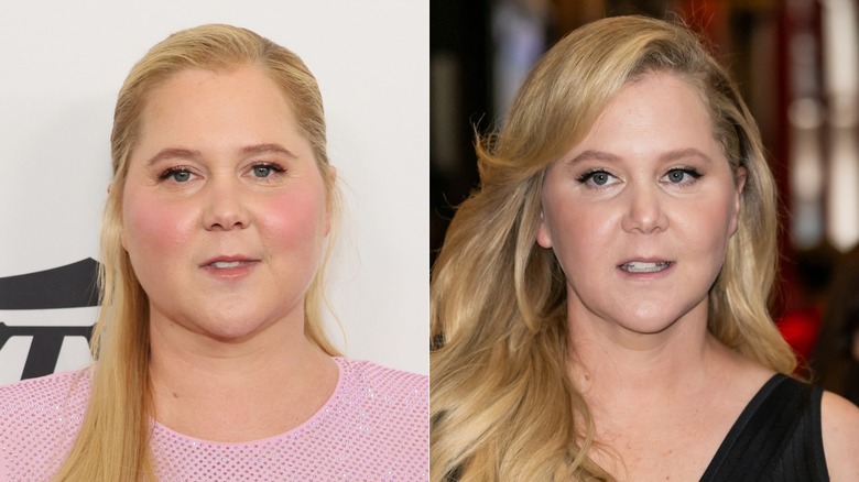 Before-and-after pics of Amy Schumer show just how weight loss ...