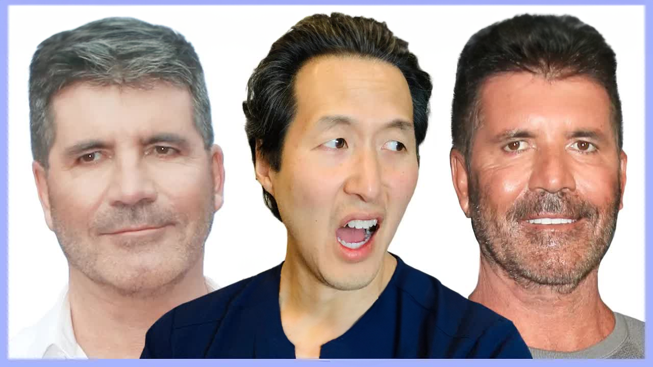 What happened to Simon Cowell's face? Doctor reacts to Simon's plastic ...