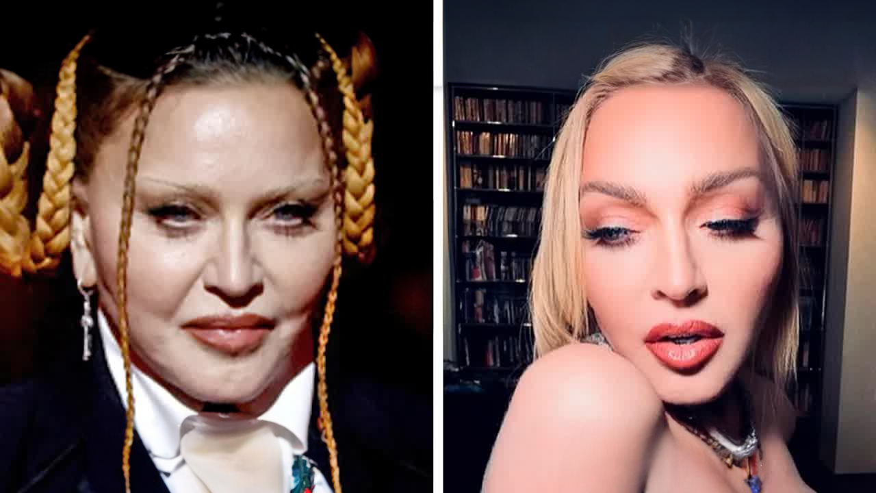 Plastic surgeon reacts to Madonna’s cosmetic surgery transformation