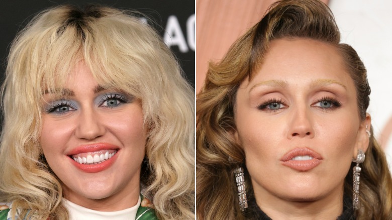 Side-by-side photos of Miley Cyrus' face transformation are shocking