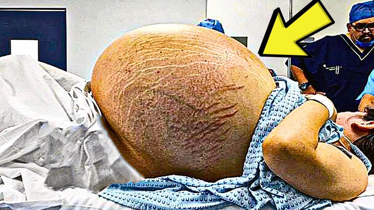 Doctors make an unexpected discovery during a pregnancy believed to be ...