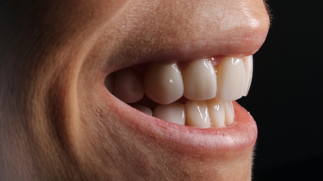 Big Japan study: Better teeth may add years to life