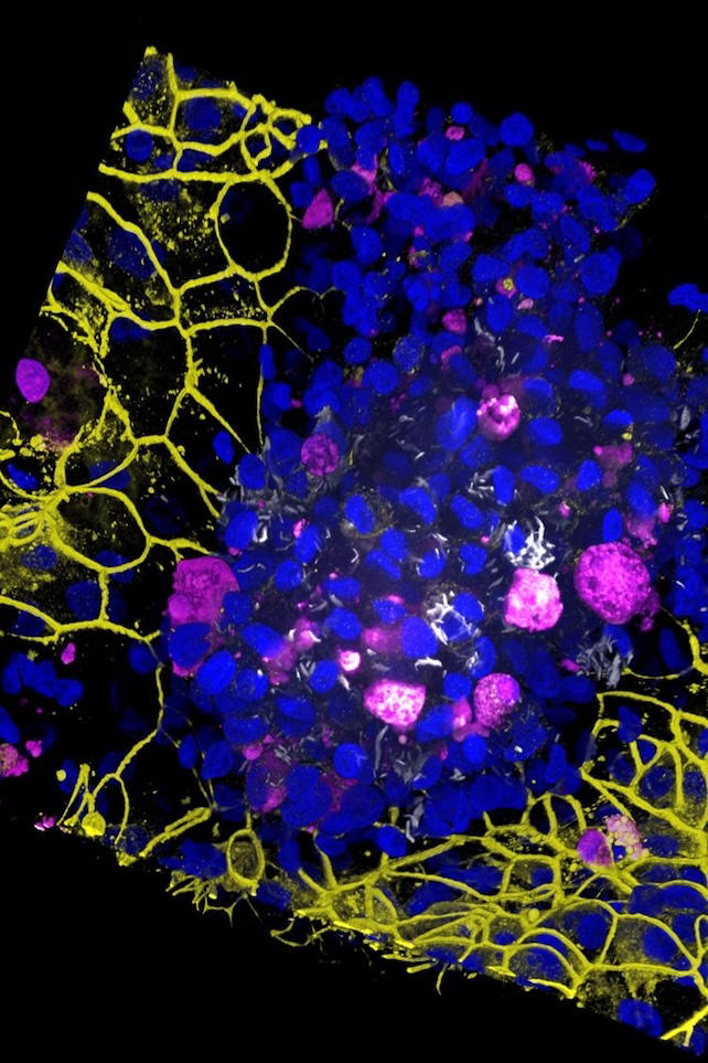 Scientists made this lung-on-a-chip breathe. Then they gave it TB.