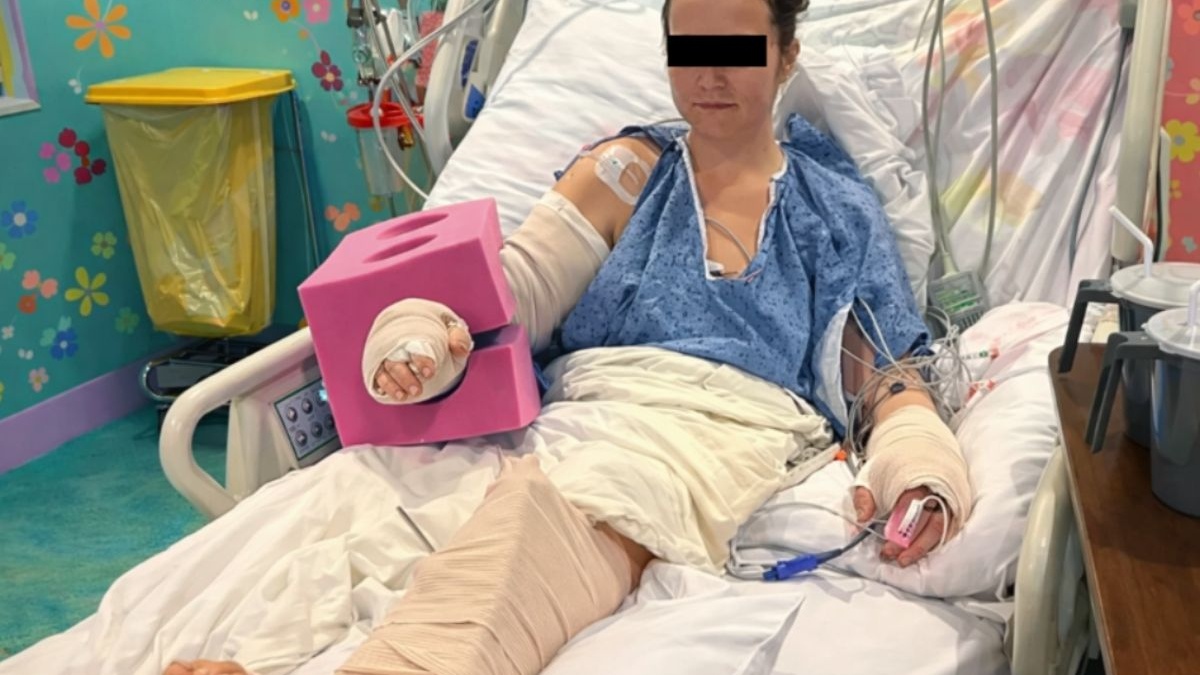 Amputar o años de cirugías: la durísima elección de una dueña de ...