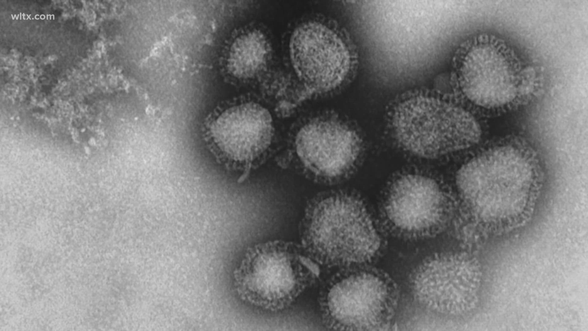 Worst flu season in decades with cases still rising