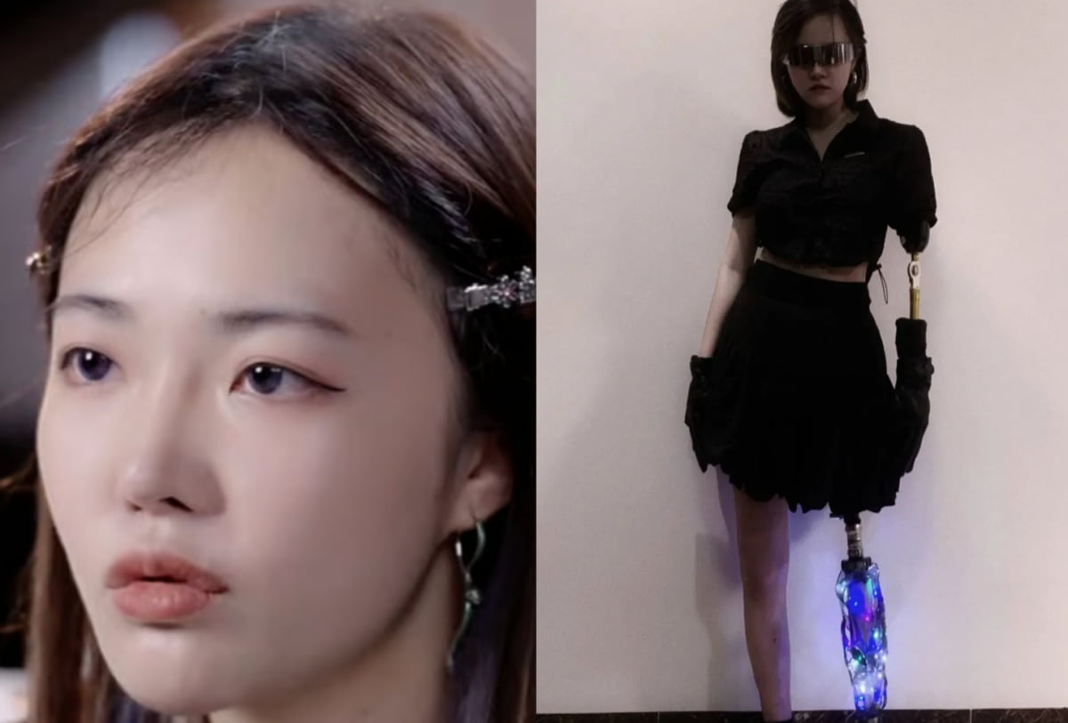 월 6300만원 번다…교통사고로 팔·다리 잃은 30대女 대박