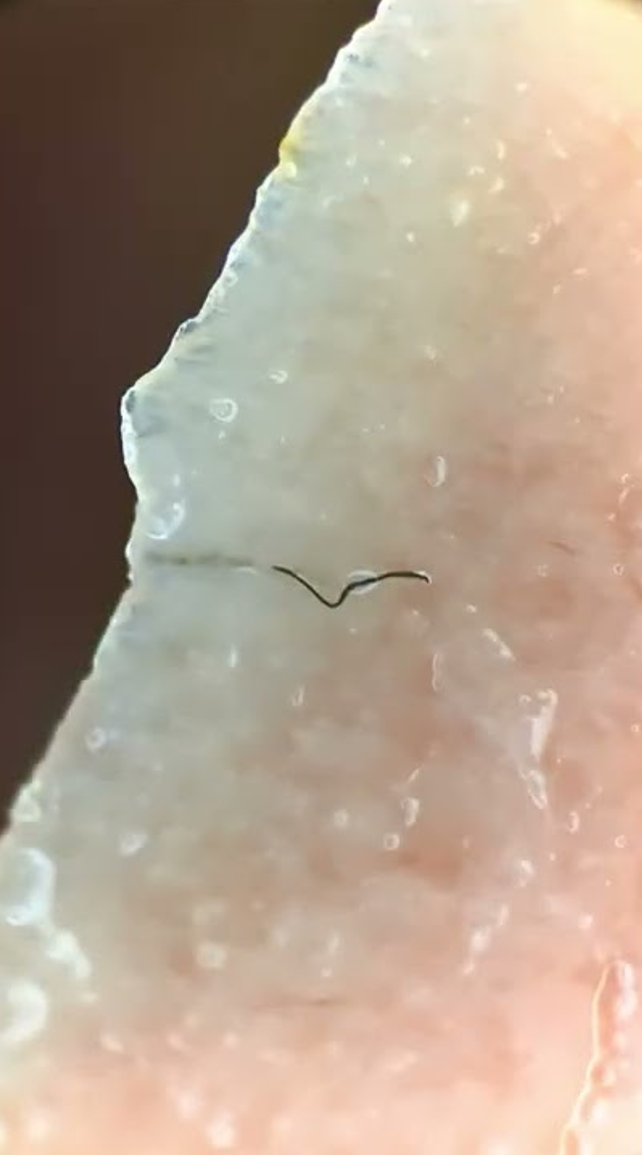 Canned tuna under the microscope reveals a shocking find!