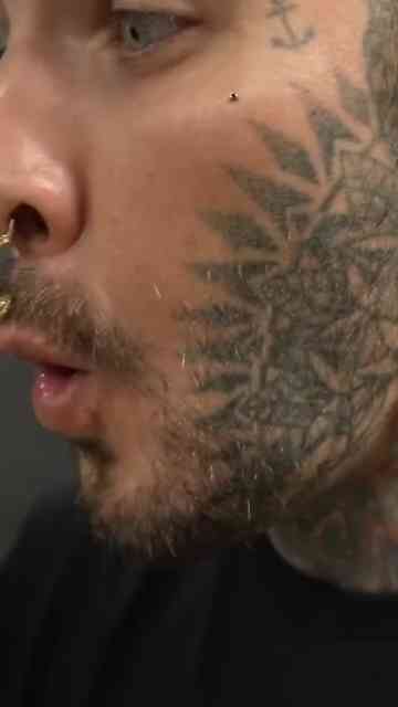 Why a pair of albino vipers is drawing national attention