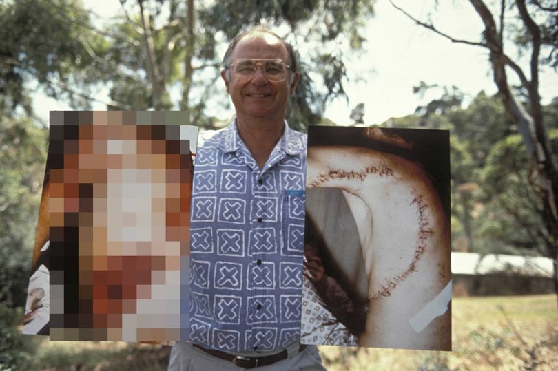 Diver's horrifying eight words as great white shark ripped open his abdomen