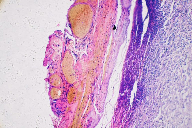 Going grey? Scientists discover unusual sign your body could be ...