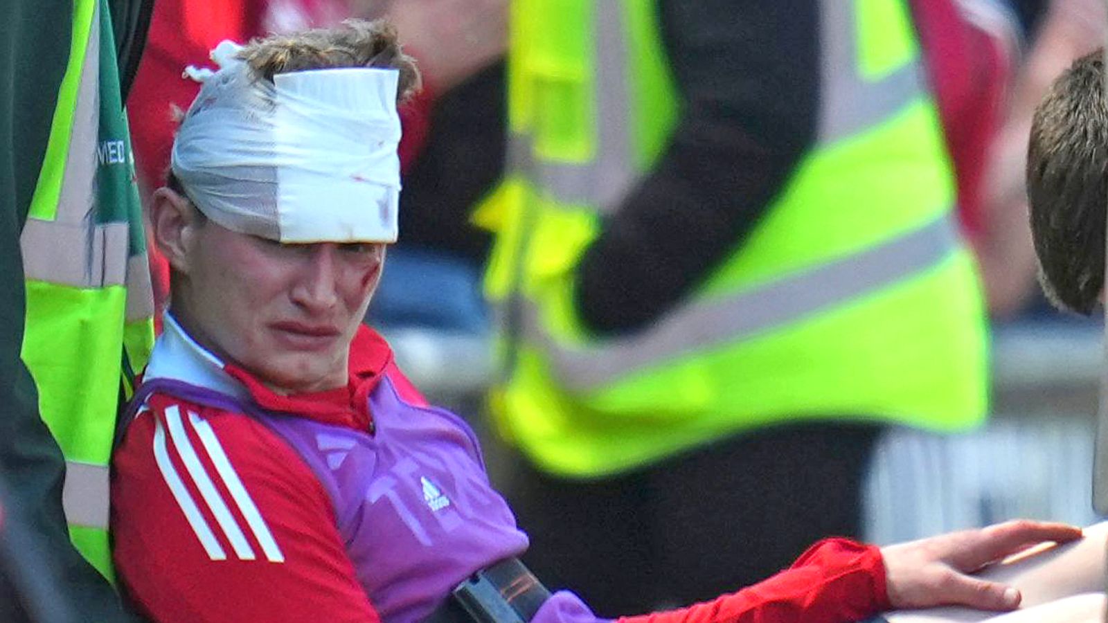 Man who struck and disfigured footballer after throwing seat at game jailed