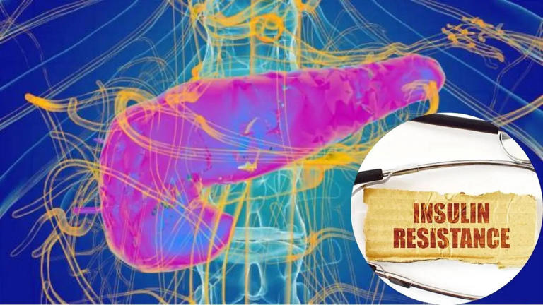 Dark, velvety patches on skin may signal insulin resistance, early ...