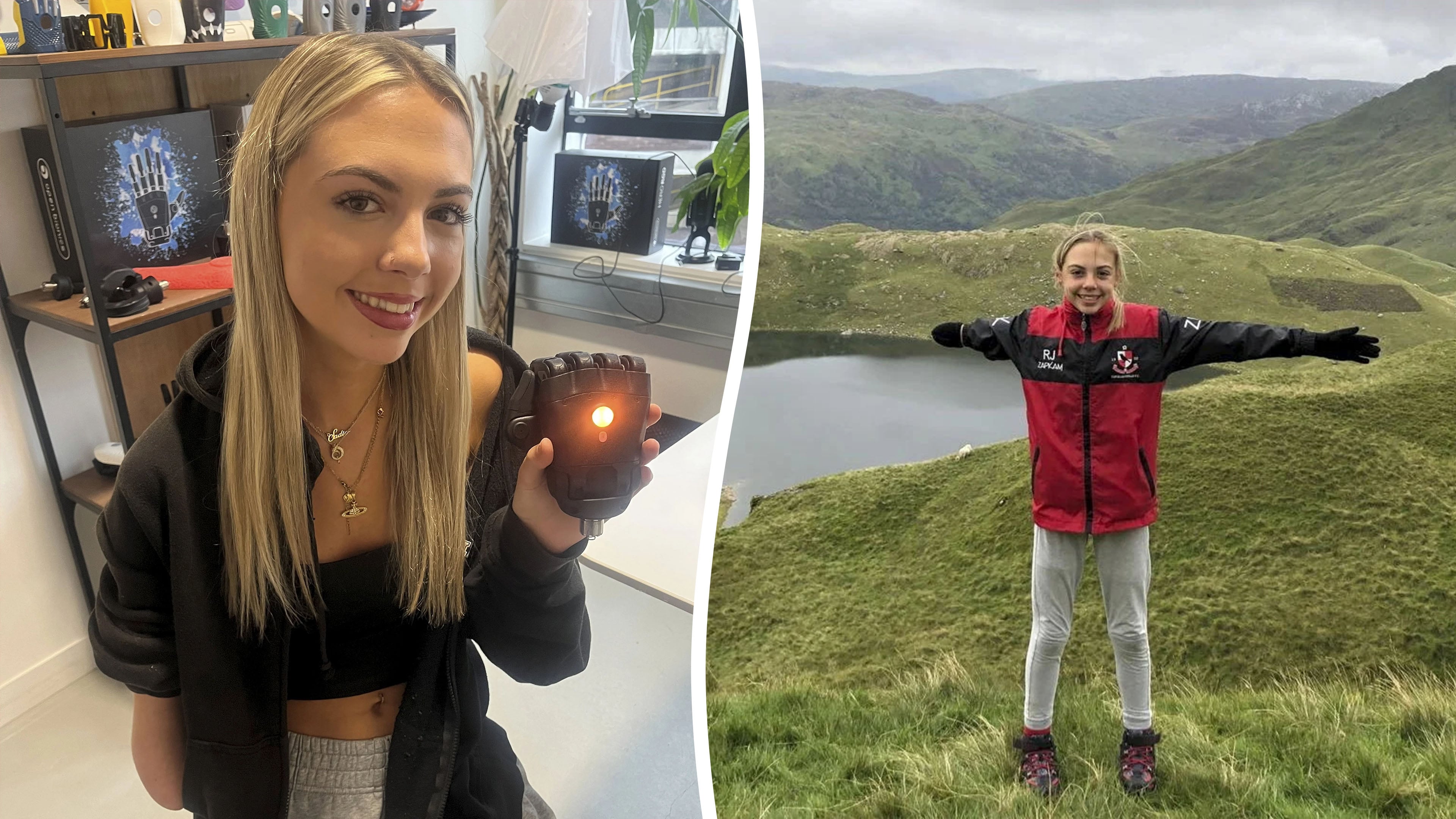 Teen appeals for bionic arm to help her drive - and push trolley in ...