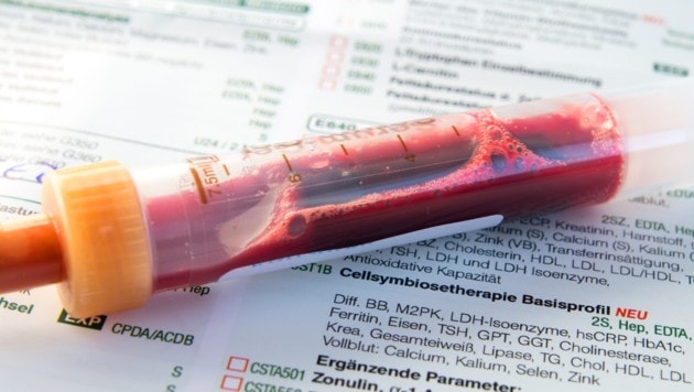 Kleiner Pieks: „Blut verrät mehr, als man denkt“