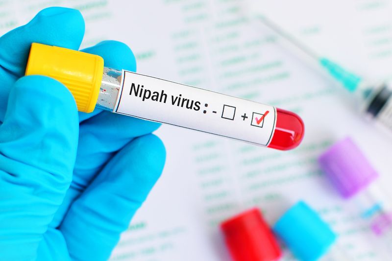 2 suspected cases of Nipah virus detected at AIIMS Kalyani; Centre ...