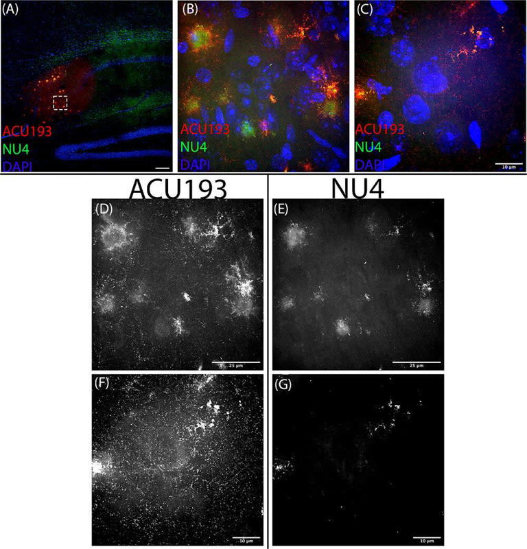 Experimental drug can sharply reduce amyloid beta's impact on Alzheimer’s