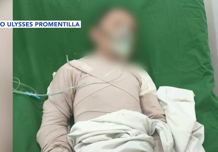 8,000 QC households hit by power outage due to foiled cable theft—Meralco