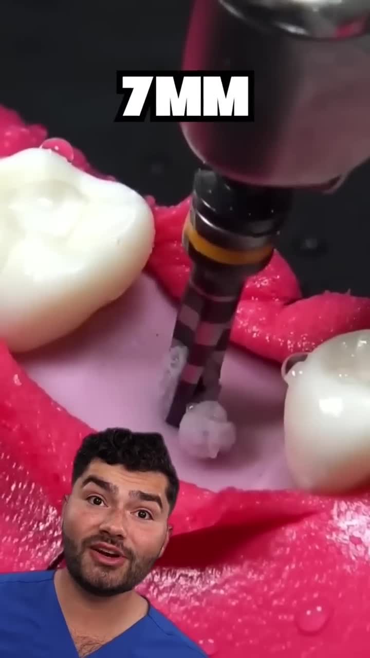 Dental implant explained?