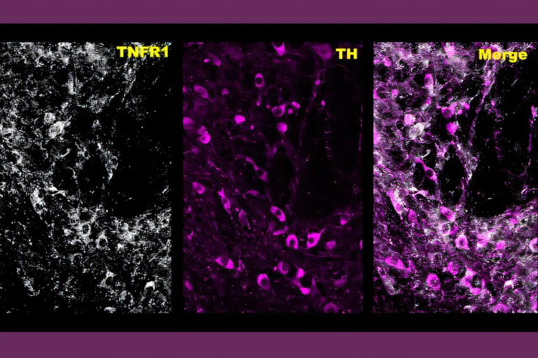 Unexpected finding could offer new treatment targets for meth addiction
