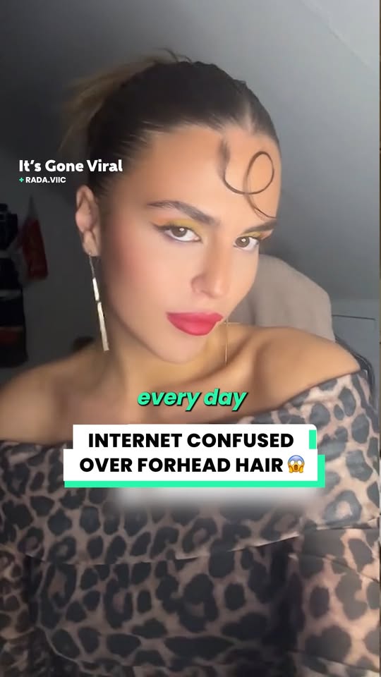 Her forehead hair confused everyone