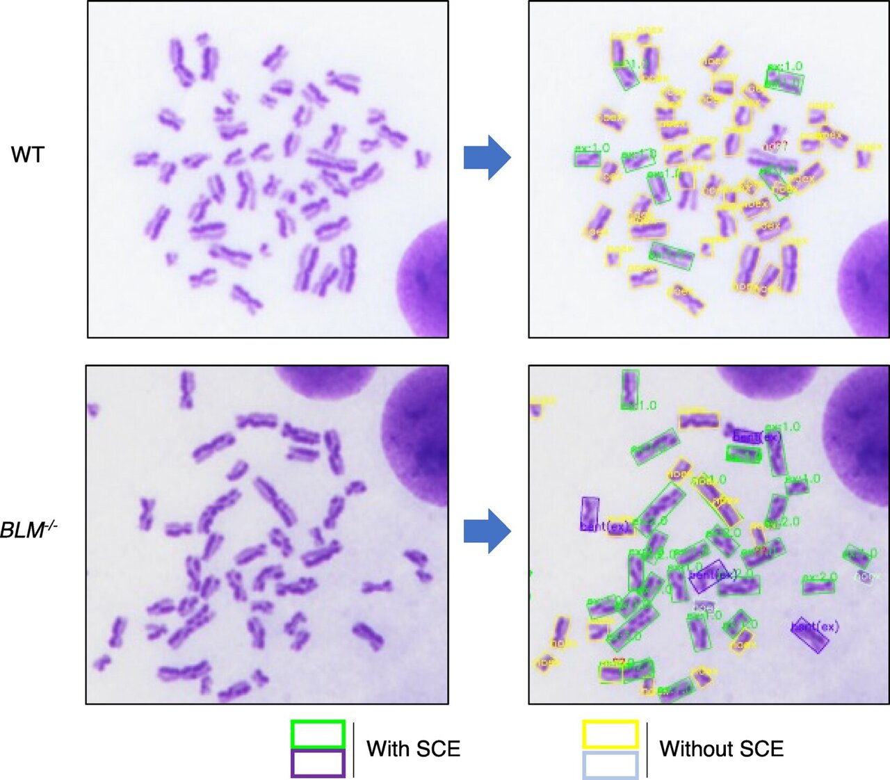 Eye for trouble: Automated counting for chromosome issues under the ...