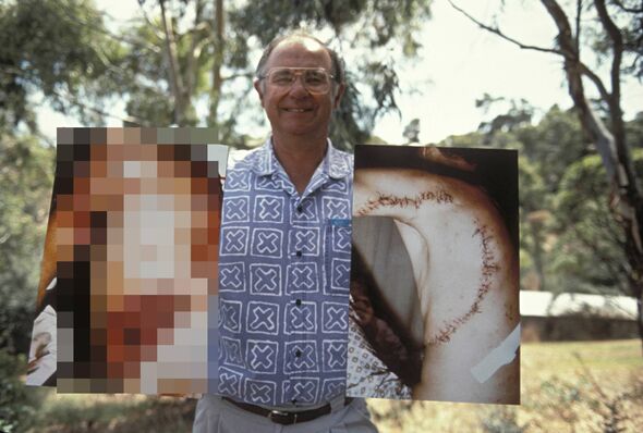 'Shark ripped open my chest, leg and abdomen and I survived'