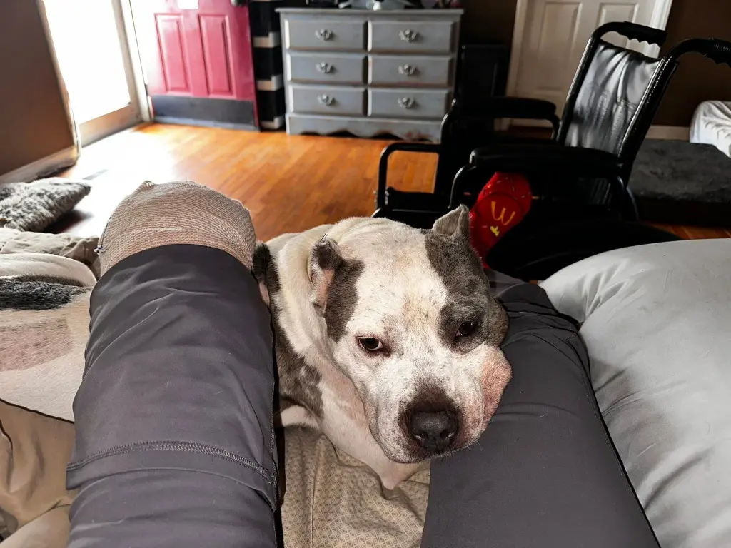 Tennessee mom loses leg after pit bull attack left her limb basically ...