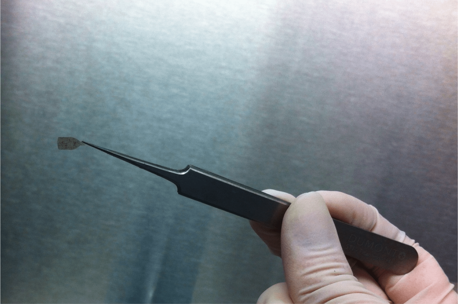 Tiny eye implant could restore vision lost to macular degeneration